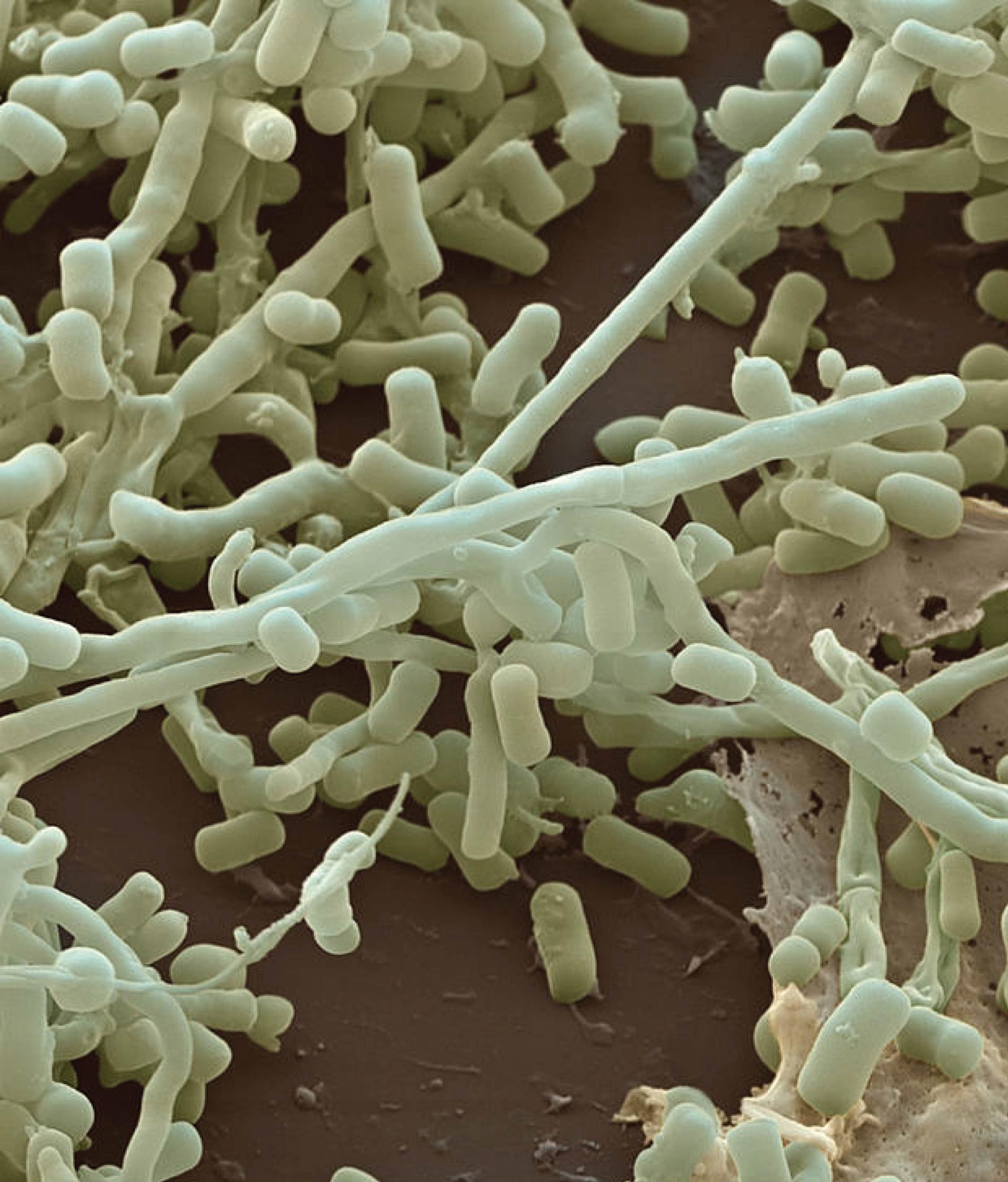 Ứng dụng xạ khuẩn Streptomyces sp trong nông nghiệp